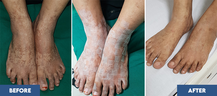 Gallery - Procedures