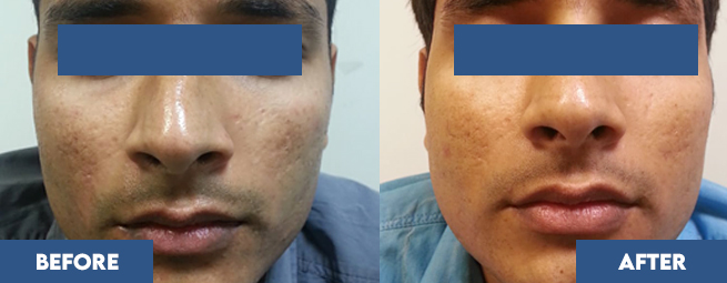 Gallery - Procedures