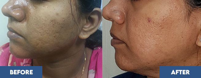 Gallery - Procedures