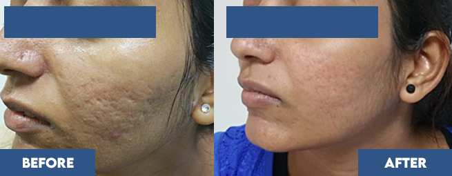 Gallery - Procedures