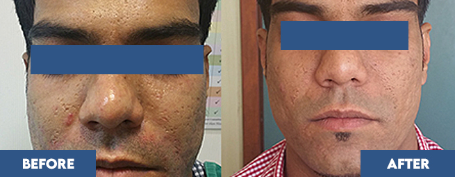 Gallery - Procedures