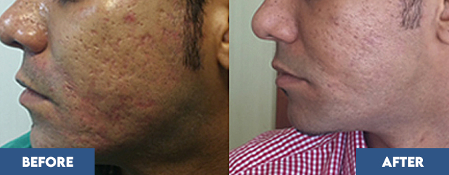 Gallery - Procedures