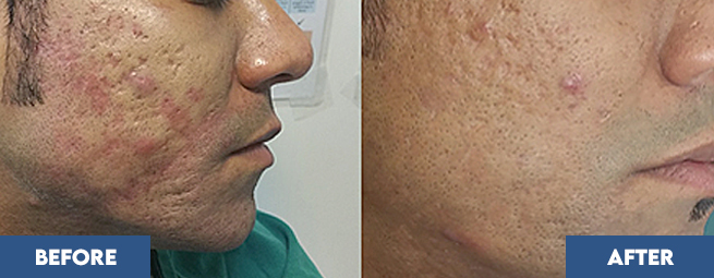 Gallery - Procedures